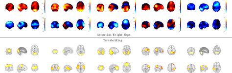 Spatial Temporal Convolutional Attention For Mapping Functional Brain Networks