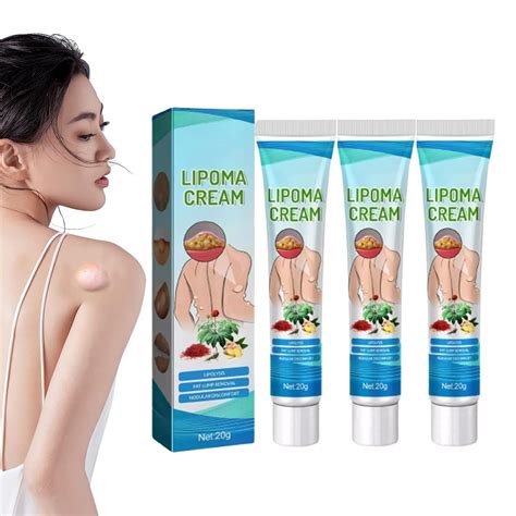 Herbal Lipoma Removal Cream Fatty Lumps Remover Indonesia Ubuy