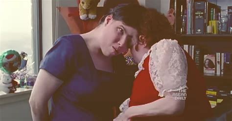 Fearless Conjoined Twins Embrace Individuality And Intimacy Despite Challenges The Asean Daily