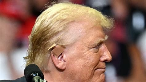Bullet That Hit Trumps Ear Left 2cm Wound Says Ex White House Doctor