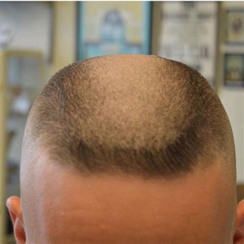 Horseshoeflattop Hashtag On Instagram • Photos And Videos Flat Top