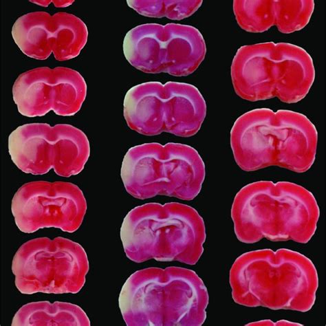 Tetrazolium Staining Revealed Ischemic Region Of The Brain Loss Of Download Scientific Diagram