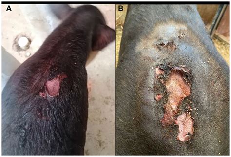 A Interscapular Vesicles And Ulcers B Ulcers Surrounded By Shaved