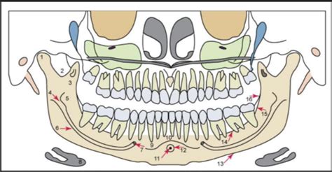Radiography Ch 29 Panoramic Anatomy Flashcards Quizlet