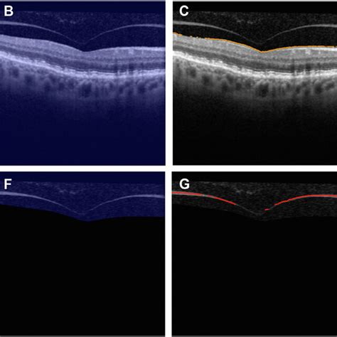 Stepwise Image Processing Illustration For Customized Posterior
