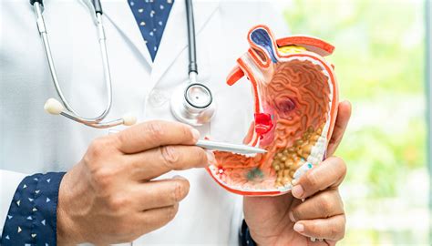 Revolutionizing Gastric Cancer New Genetic Classification Emednews