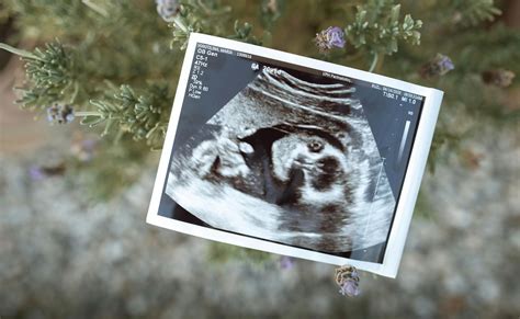Controversy Erupts As Us Startup Offers Opportunity To Genetically
