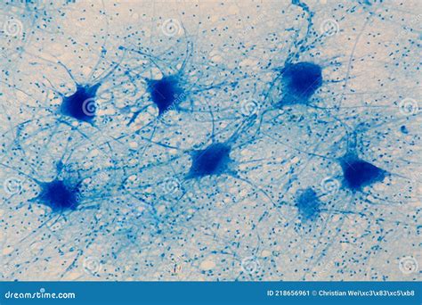 Motor Neurons Under The Microscope Stock Image Image Of Histology Dendrite 218656961