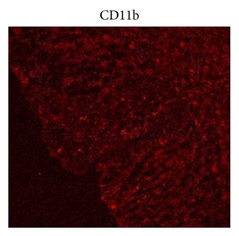Colocalization Of Egfp Expressing Cells Positive For Viral Antigen