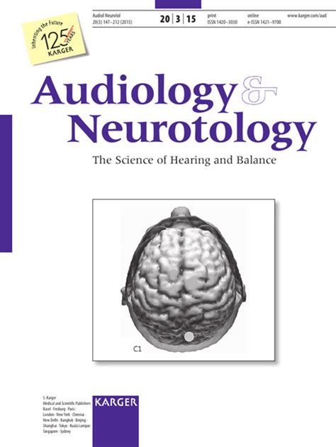 Interaural Level Difference Cues Determine Sound Source Localization By Single Sided Deaf