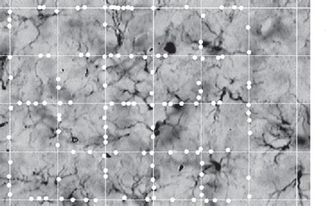 figure 1 from neocortical and hippocampal glial fibrillary acidic