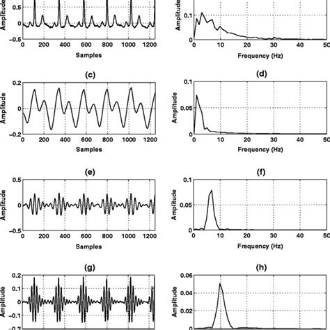 Block Diagram Of Proposed Method For Detection Of Shockable Ventricular Download Scientific