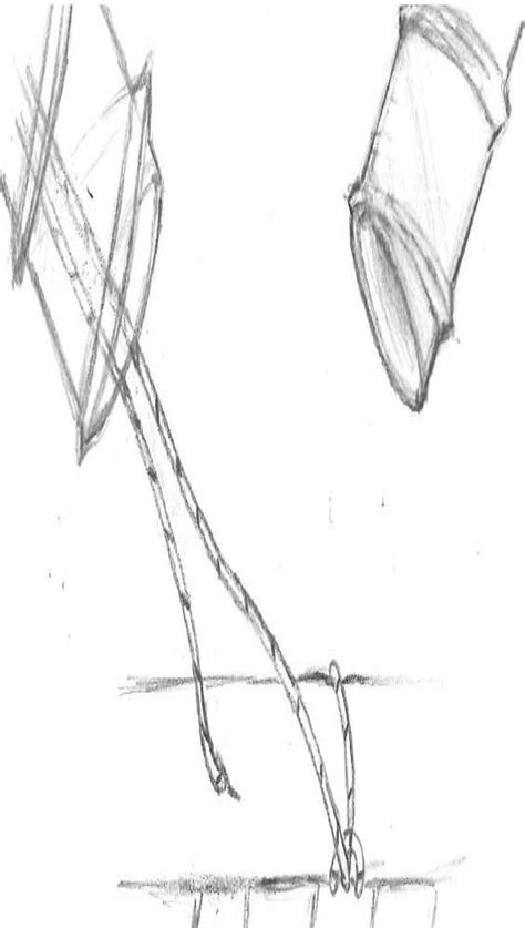 The Oblique Mattress Lasso Loop Stitch For Arthroscopic Capsulolabral Repair Arthroscopy