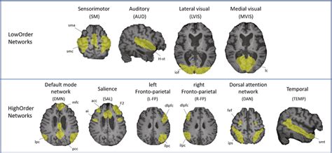 Templates Of Loworder And Highorder Brain Networks The Binary Mask Of Download Scientific