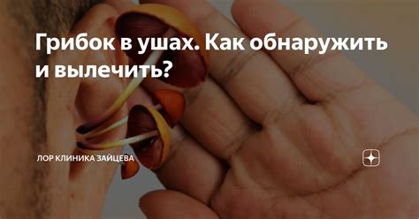 Грибок в ушах. Как обнаружить и вылечить? | ЛОР КЛИНИКА ЗАЙЦЕВА | Дзен