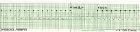 Float Nurse Pediatric Svt