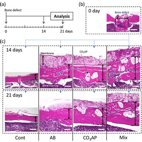A Tibia Defect And Preparation Of Autogenous Bone A Hole Was Created