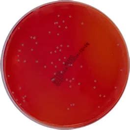 Burkholderia Cepacia Selective Agar Base Bcsa Scharlab