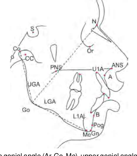 Gonial Angle