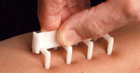 At Home Allergy Testing Virtual Allergy Screening