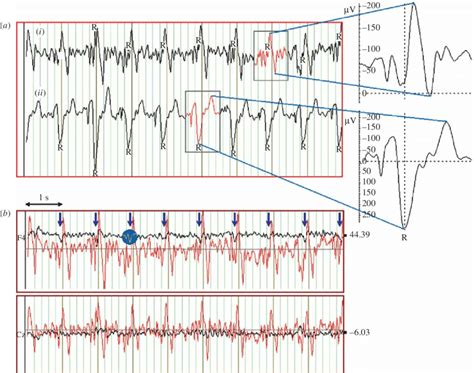 A The Time Series Corresponding With I An Eeg And Ii The Ekg