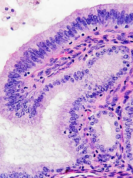 Endometrium Wall Art For Sale By Science Source Prints