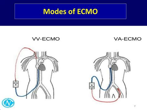Ppt Ecmo Powerpoint Presentation Free Download Id7343122
