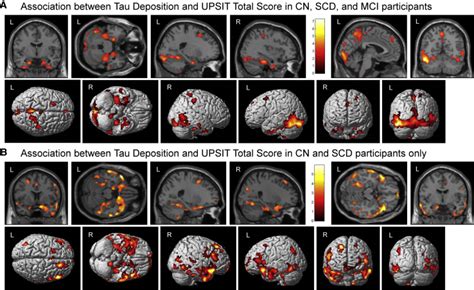 Olfactory Identification In Subjective Cognitive Decline And Mild