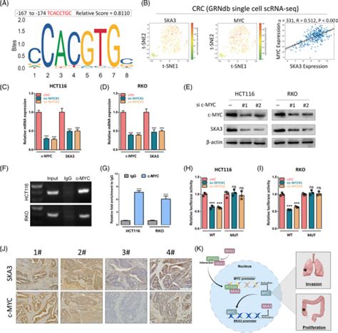 Ska3 Pttg1 C‐myc Signal Loop Drives The Progression Of Colorectal Cancer Pmc
