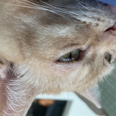 Yiting Chen Taiwan Mackay Memorial Hospital Taipei Fd Research Profile