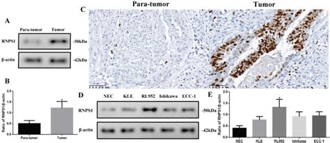 Rna Binding Protein With Serine Rich Domain 1 Regulates Microsatellite