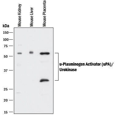 U Plasminogen Activator Upa Urokinase Products Randd Systems