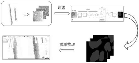 基于深度学习的病理图像病变分割方法及系统与流程