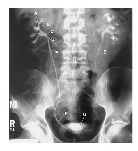Image Analysis Urinary Diagram Quizlet