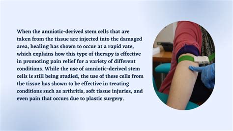 Ppt What Are Uses For Amniotic Derived Stem Cell Treatments