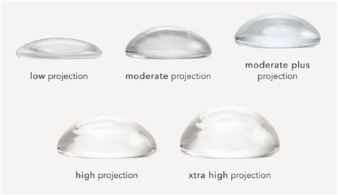 Breast Implant Types Silicone Vs Saline Compared 2026