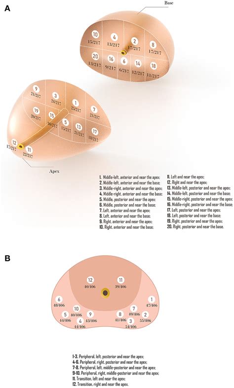 A Representative Trans Perineal Template Guided Mapping Biopsy Download Scientific Diagram