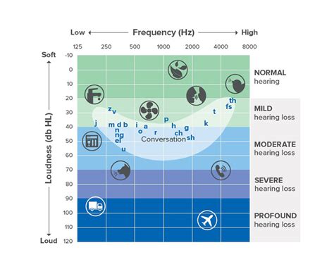 Audiograms What Is An Audiogram And How To Understand It