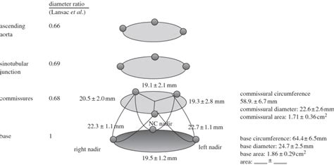 Aortic Root Geometry At End Diastole Data From Dagum Et Al And