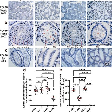The Clpp Clpx Cko Mouse Exhibits Abnormal Histological Structure Of Download Scientific Diagram