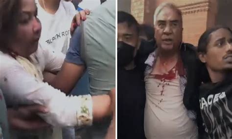 देउवा दम्पती डिस्चार्ज हुँदै ललितपुरमा अस्थायी बसोबास Nepal Press