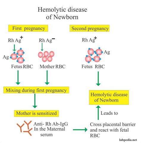 Anti E Antibody Jaundice At Alice Fisher Blog
