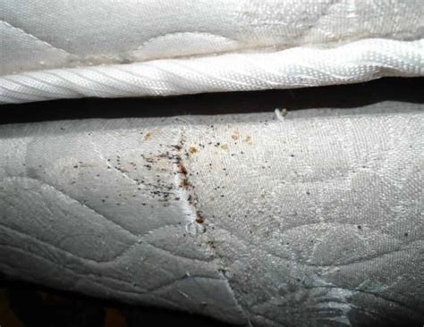 Scabies In Hotels What You Need To Know Hotel F And B