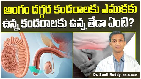 Is The Penis A Muscle Or An Organ Erectile Dysfunction Causes And