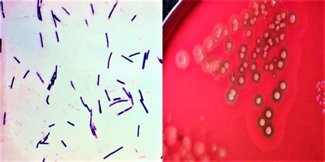 Morphology And Culture Characteristics Of Clostridium Perfringens