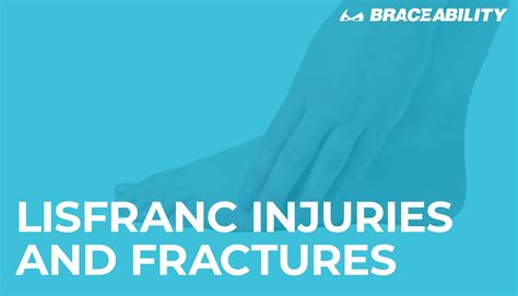 Lisfranc Fractures And Injuries Dislocations Sprains And Foot Surgery
