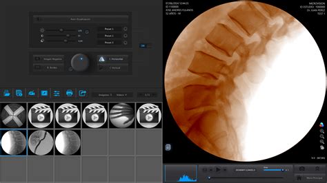 Microvision Professional Microvision Software