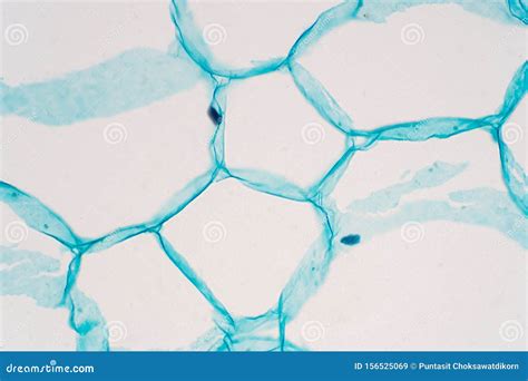 Cross Sections Of Plant Stem Under Microscope View Show Structure Of Parenchyma Cells Stock