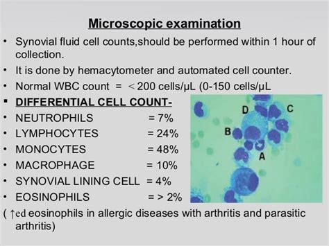 How To Perform Cell Counts On Body Fluid Ylimgz