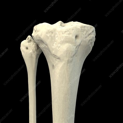 Tibia And Fibula Bones Illustration Stock Image F0457952